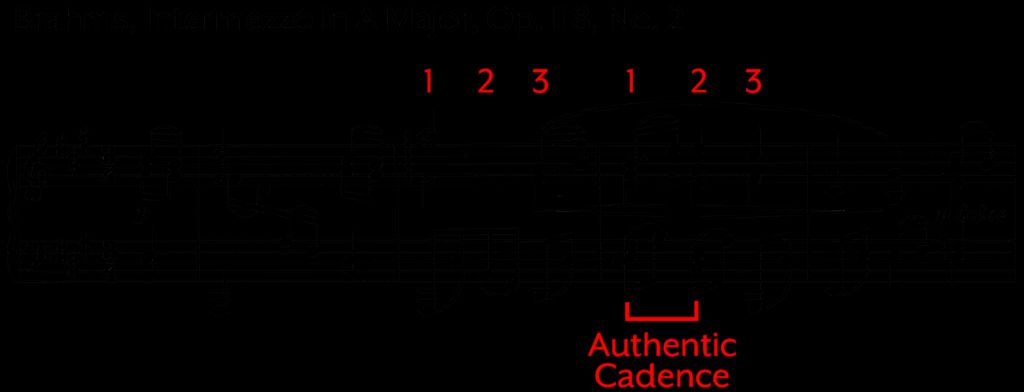 Cadence in Music Theory: Defining Endings & Transitions