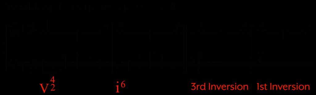 Cadence in Music Theory: Defining Endings & Transitions