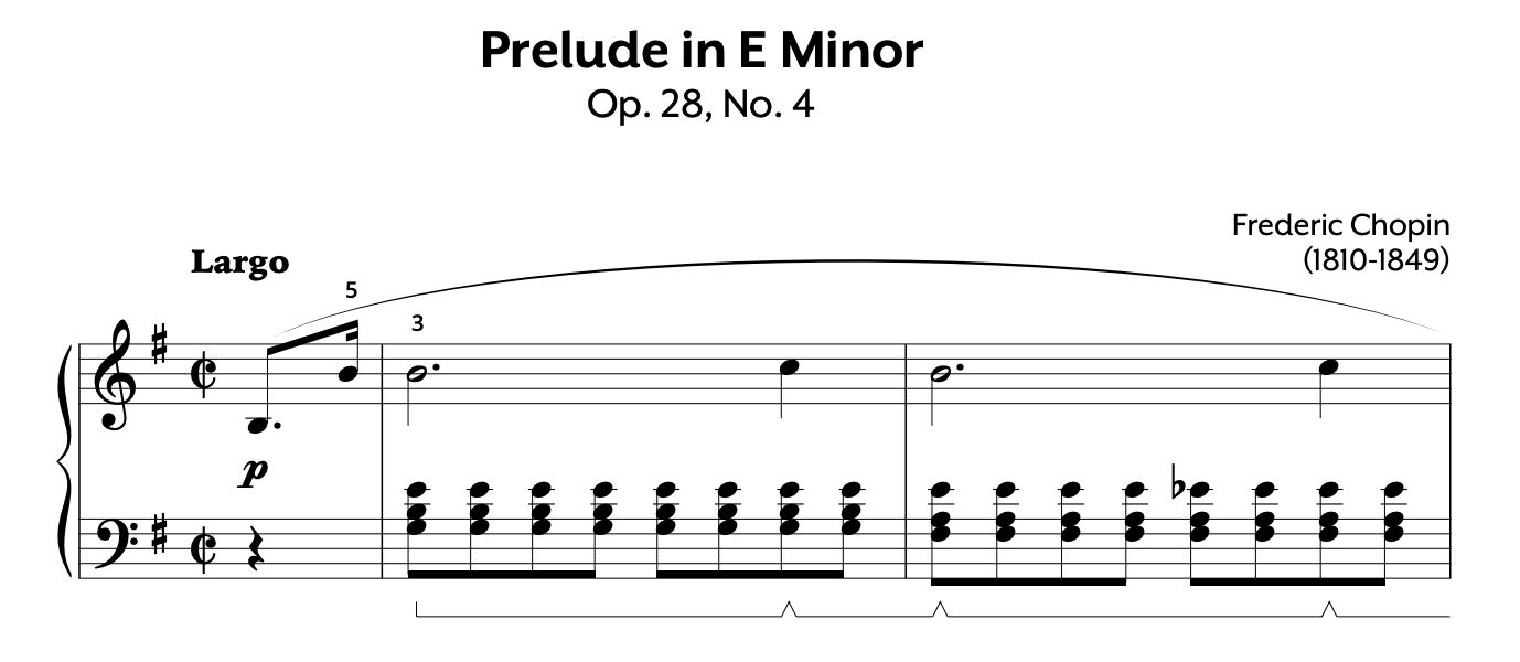9 Chopin Pieces to Learn | Famous, Popular, Easy - Advanced